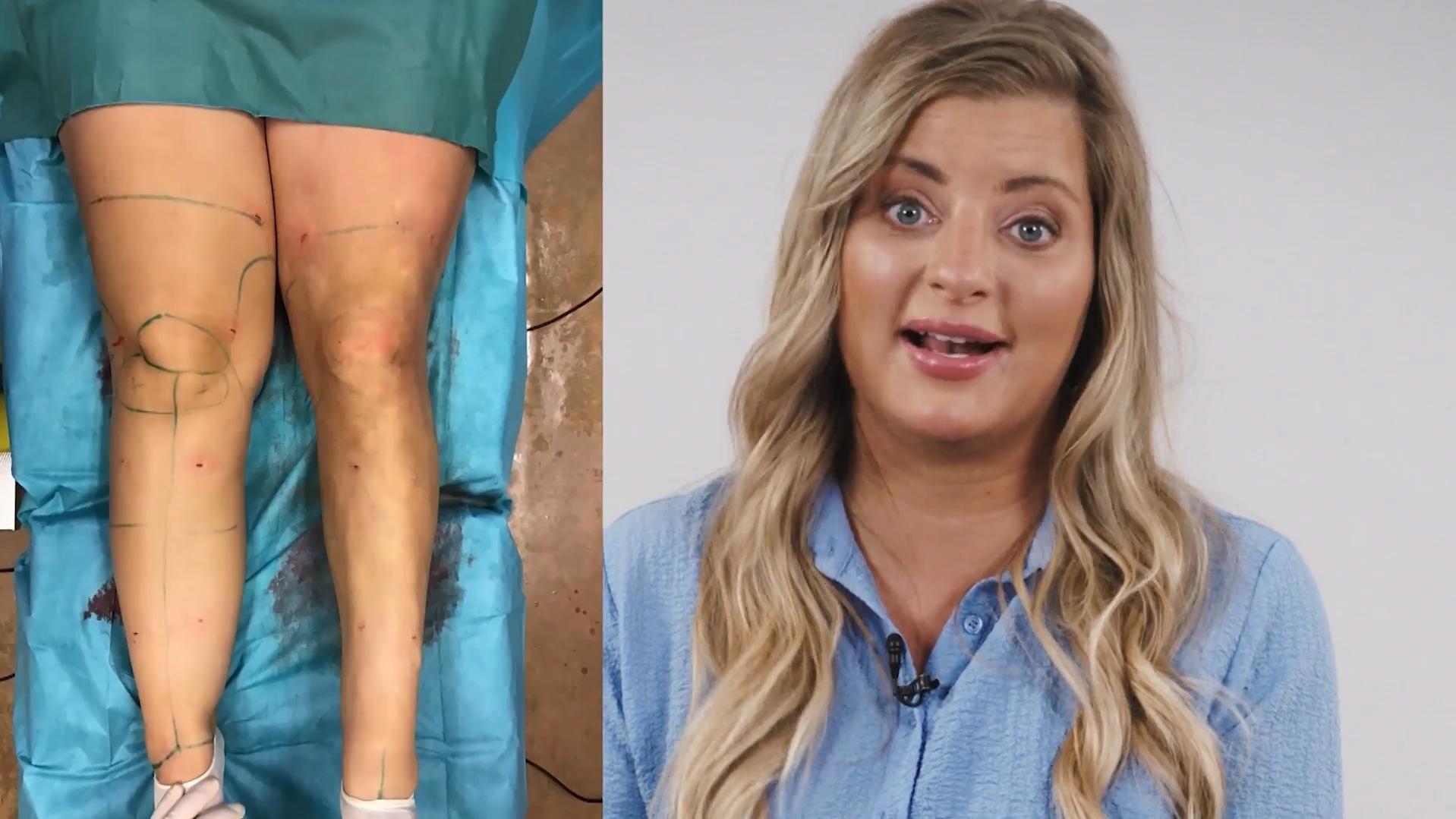 Fiese Sprüche gegen Laura Larsson: "Du bist nur zu faul, um Sport zu ...